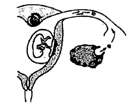 A single-celled embryo forms, containing twice the number of chromosom