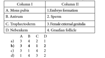 Match column I with column II and select the correct option using the