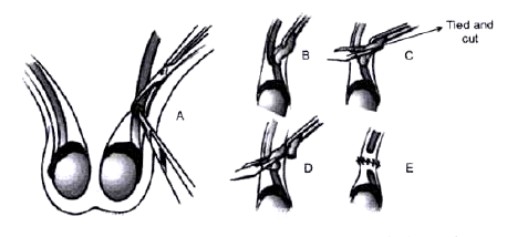 Analyse the given diagram and answer the questions based on it:
