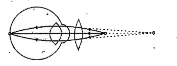 Make a diagram to show how hypermetropia is corrected. The near point