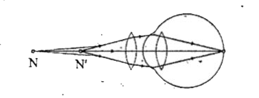 Make a diagram to show how hypermetropia is corrected. The near'point