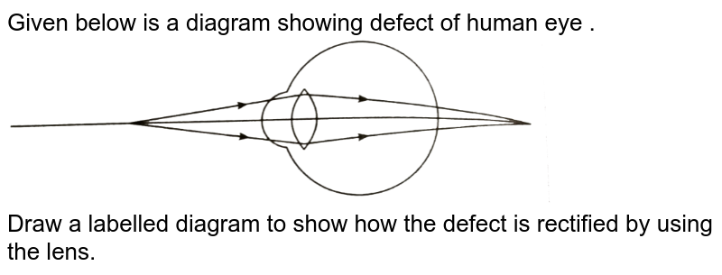 Given below is a portion of the diagram to show the diagrammatic h