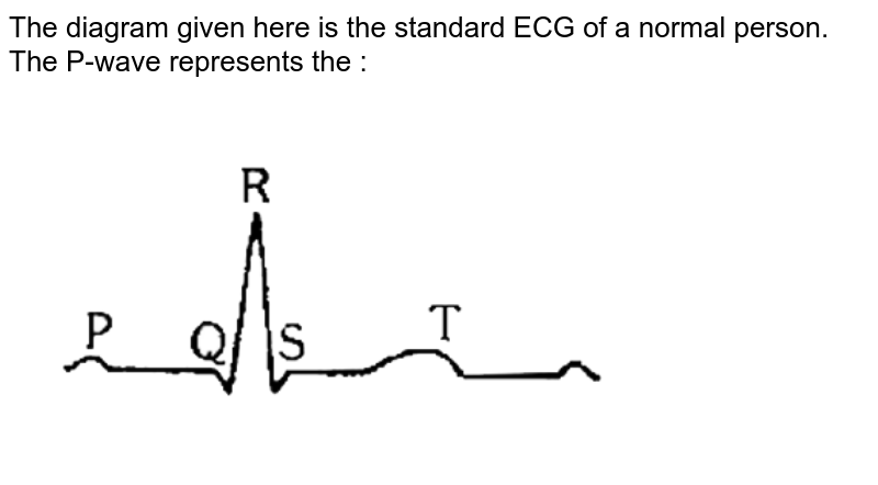 The diagram given here is the standard ECG of a normal person. Th