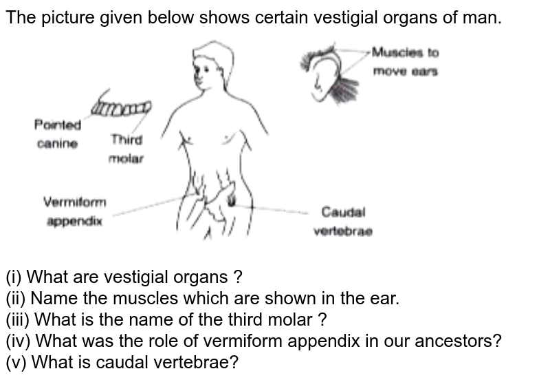 Which one is not a vestigial organ in man ? a Vermiform appendix