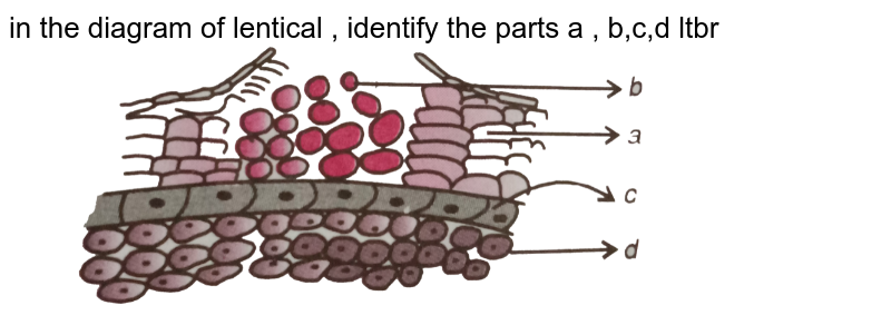 Phelloderm is formed of A Phellem + phellogen B Periderm + phellog