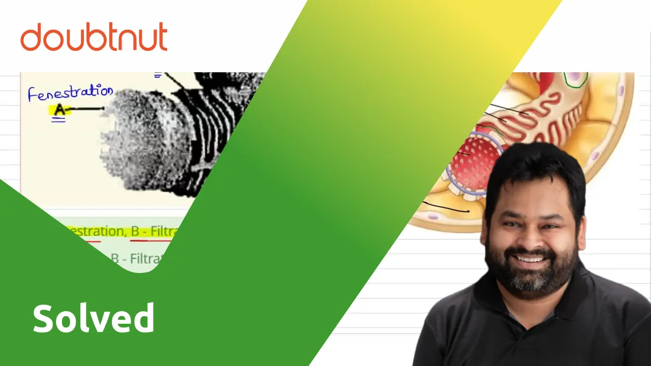 A - Filtration slit, B - Fenestration, C - Podocyte