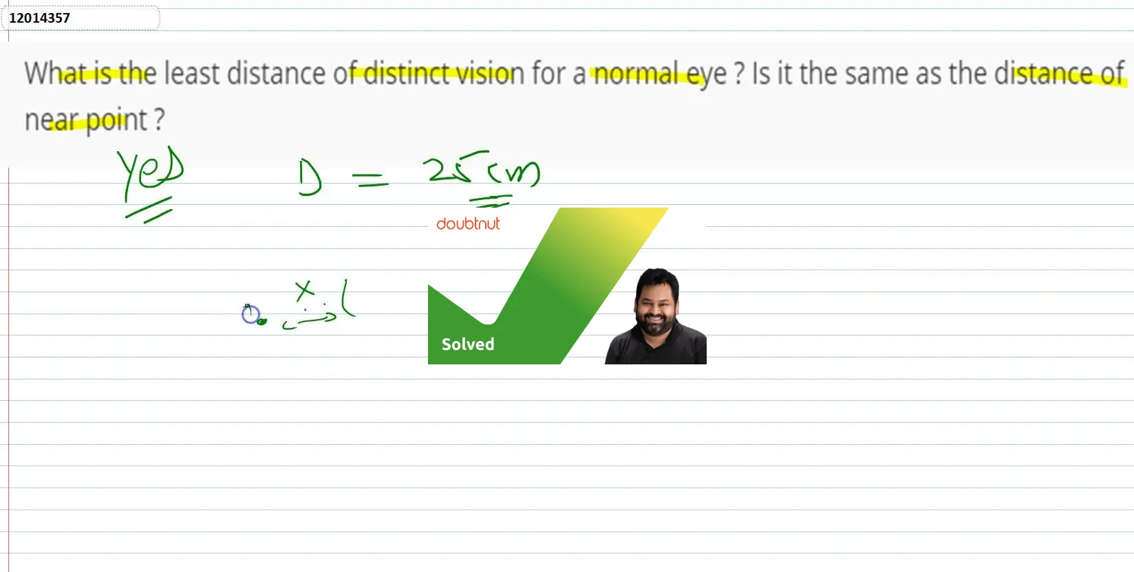 What is the least distance of distinct vision for a normal eye ? Is it